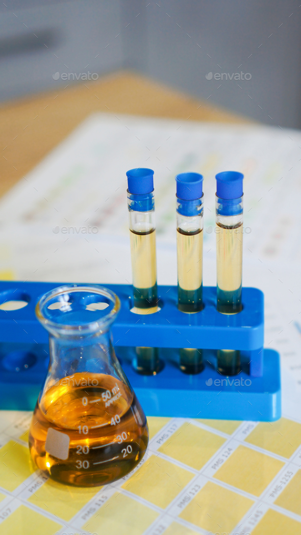 Flask and test tubes with urine on medical color schemes. Concept of ...