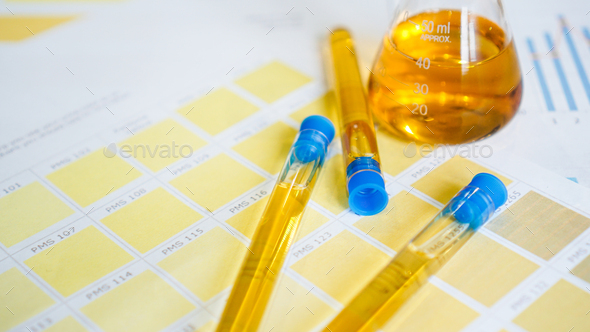 Flask and test tubes with urine on medical color schemes. Concept of ...
