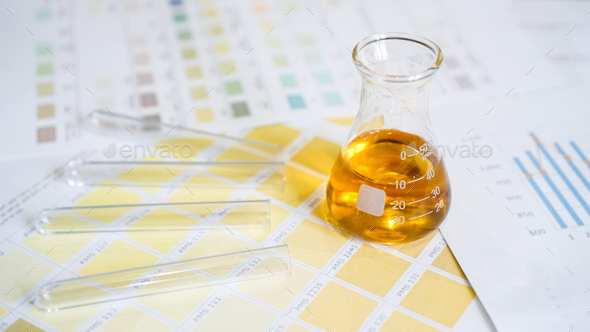 Flask and test tubes with urine on medical color schemes. Concept of ...