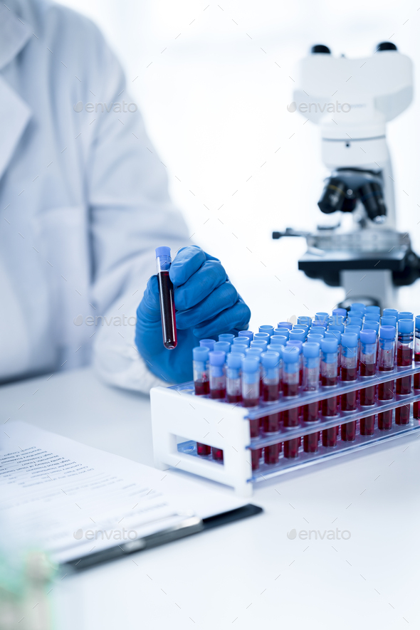 Doctor hand taking a blood sample tube from a rack with machines of ...