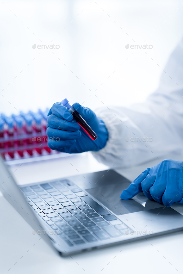 Doctor hand taking a blood sample tube from a rack with machines of ...