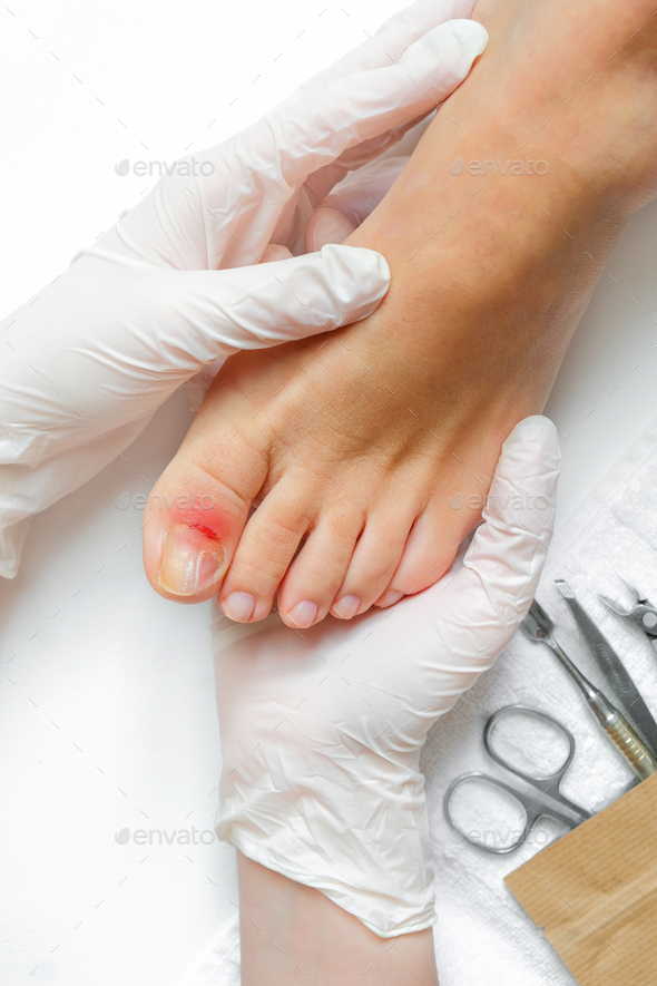 Pedicure, podologist. Patient on medical pedicure procedure, nail ...