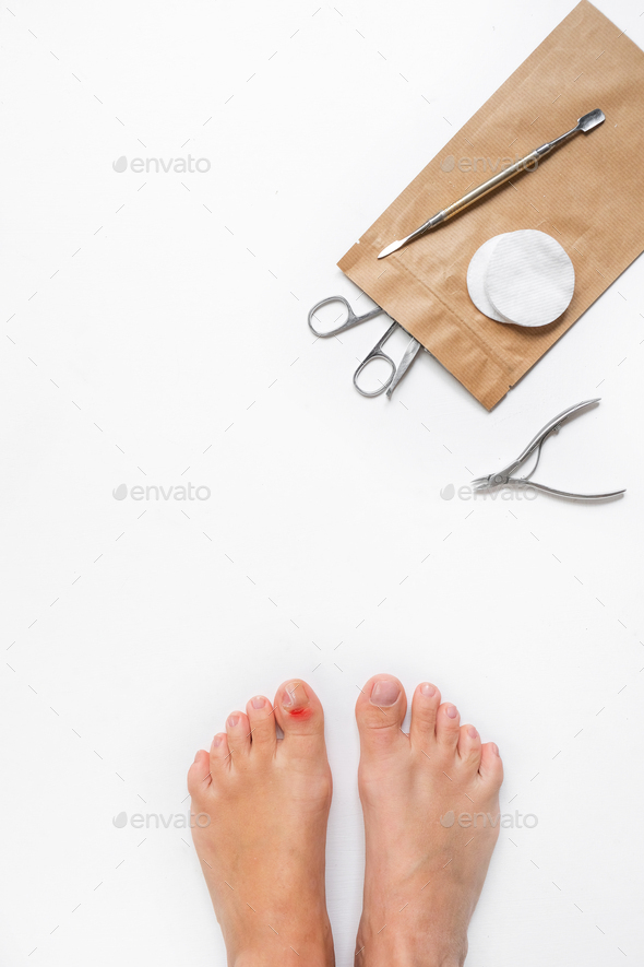 Pedicure, podologist. Patient on medical pedicure procedure, nail ...