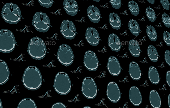 Medical image data from a CT or MRI computed tomography Stock Photo by ...