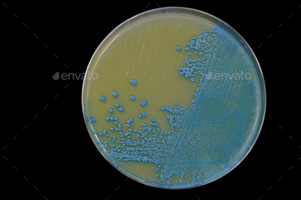 Listeria monocytogenes growing on an agar plate isolated on a black ...