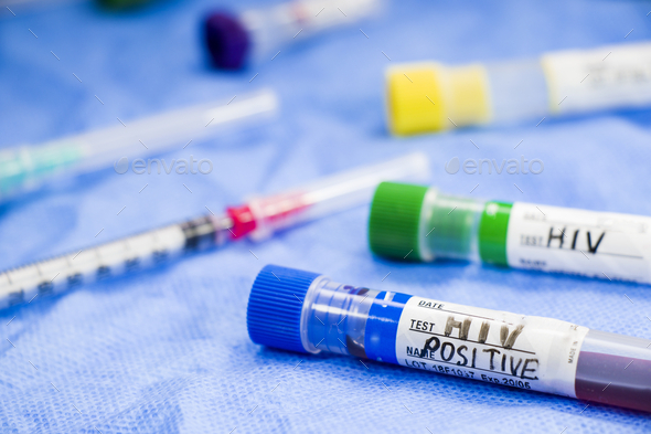 Selective focus shot of positive HIV blood specimen on test tube in the ...
