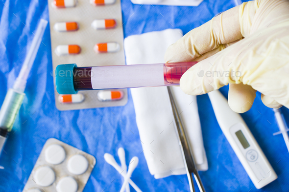 Hand in gloves holding blood test tube specimen with laboratory ...