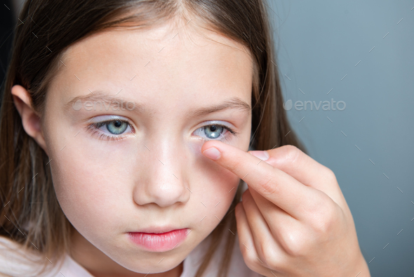 Little child girl putting contact lens into her eye, closeup Stock ...