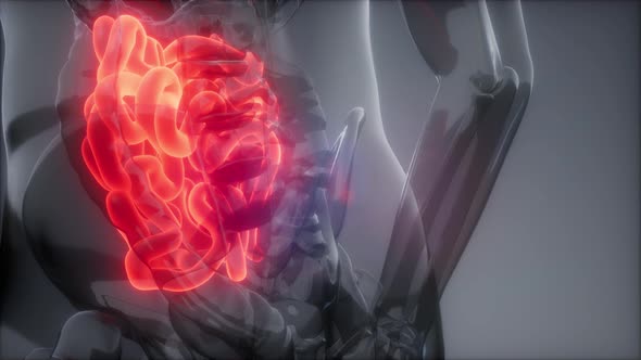Human Small Intestine Radiology Exam, Motion Graphics | VideoHive