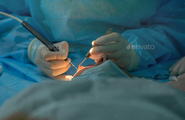 ophthalmologist performs an operation on the patient's eye. Stock Photo ...