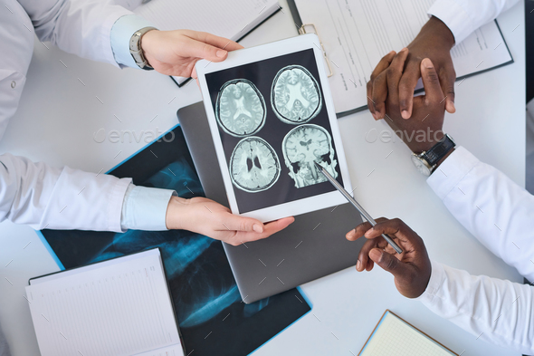 Doctors examining brain tomography image in team Stock Photo by AnnaStills