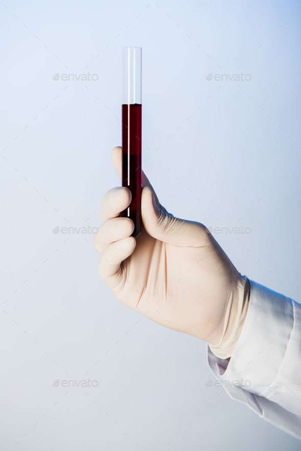 Partial view of doctor holding test tube with blood Stock Photo by ...