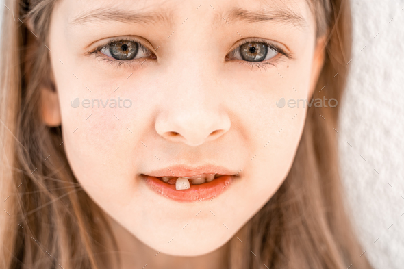 Charming smiling little girl kid with opened mouth shows staggering ...