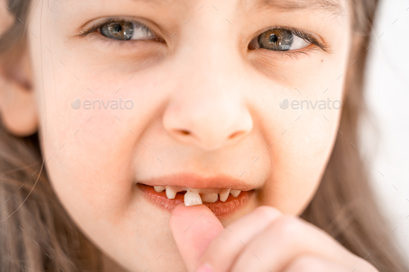 Charming smiling little girl kid with opened mouth shows staggering ...