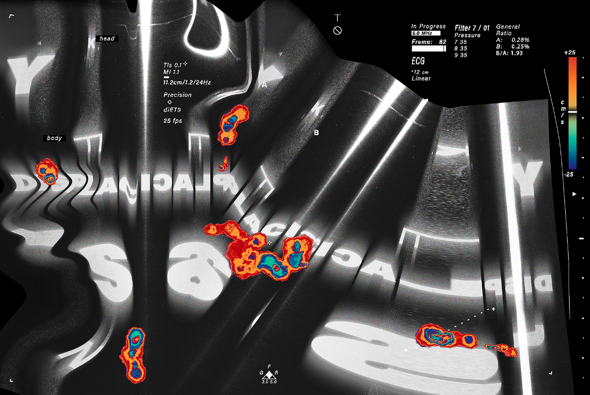 Echo Scan Distortion Effect, Add-ons | GraphicRiver