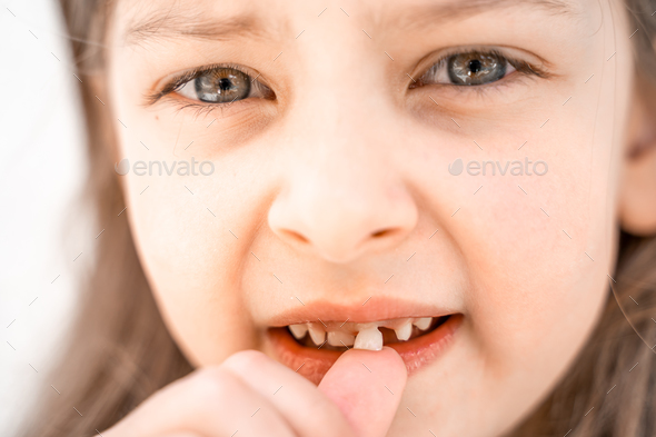 Charming smiling little girl kid with opened mouth shows staggering ...