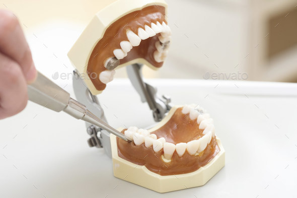 Tooth Extraction at a Japanese Dentist's Office Stock Photo by cait00sith
