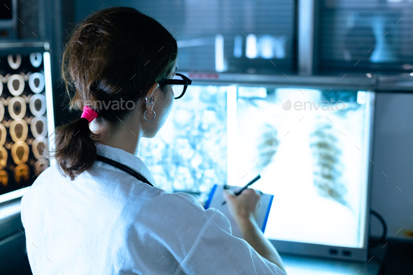 Close up back view. Doctor woman looking check up x-ray film in medical ...