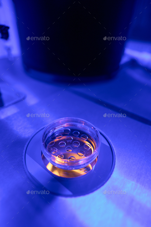 Stem cells on petri dish under microscope objective lens Stock Photo by ...