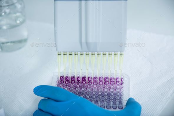 Laboratory electronic multichannel pipettes with microplate ...