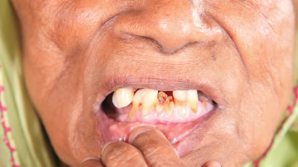 Senior Woman Showing Her Deformed Teeth, Stock Footage | VideoHive