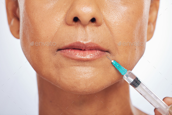 Lips, injection and face of woman for plastic surgery in studio, white ...
