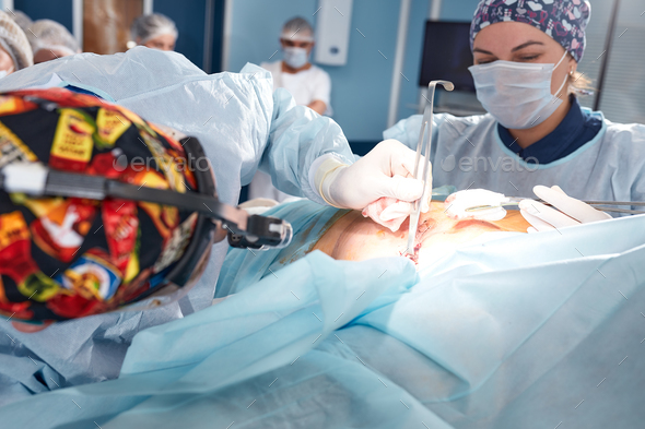 A surgeon with an assistant operates on the female breast, mammoplasty ...