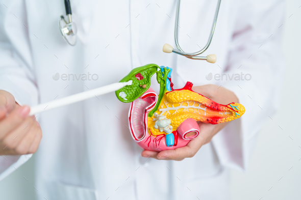 Doctor with human Pancreatitis anatomy model with Pancreas Stock Photo ...