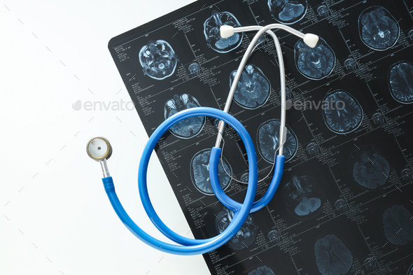 MRI or magnetic resonance imaging of the head and brain with a ...