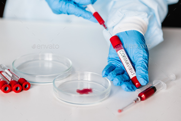 Microbiologist testing a tube with biological sample, syringe with ...