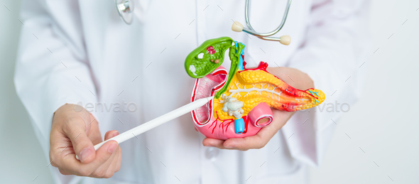 Doctor with human Pancreatitis anatomy model with Pancreas Stock Photo ...