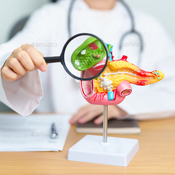 Doctor with human Pancreatitis anatomy model with Pancreas Stock Photo ...