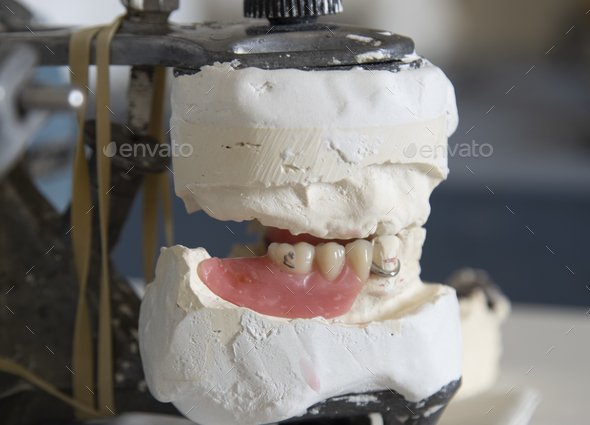 Shot of dental impression molds for reconstruction Stock Photo by wirestock