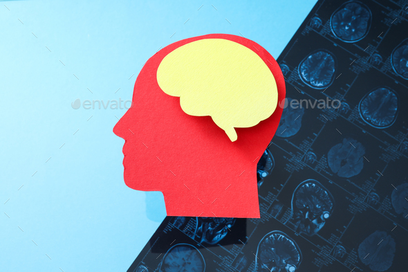 MRI images or magnetic resonance imaging with paper human head and ...