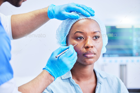 Plastic surgery, pen and black woman in a hospital with dermatology ...