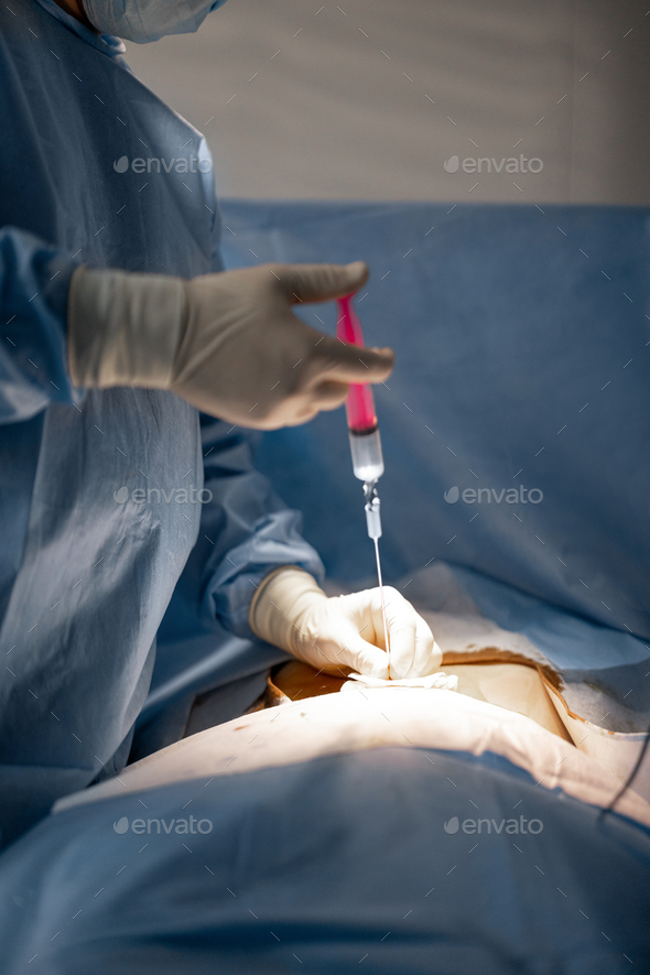Surgeon makes an injection during an operation Stock Photo by RossHelen