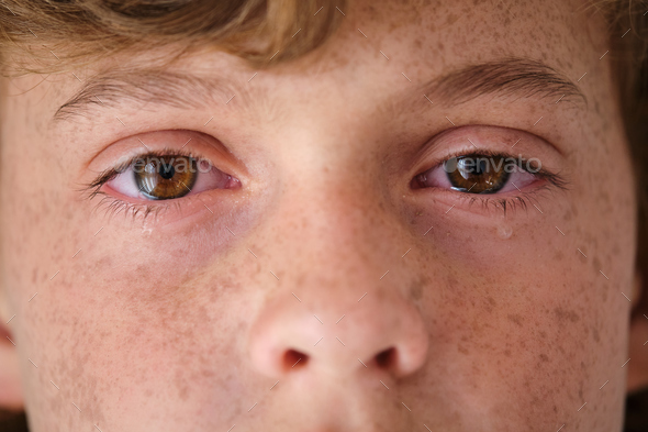 Crop crying child with freckles on face skin Stock Photo by ADDICTIVE_STOCK