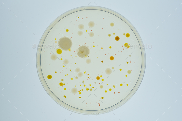 Bacterial colonies emerged on agar plate Stock Photo by Buntan2019