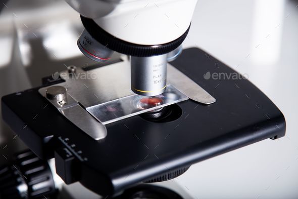 blood sample, microscope at the medicine and biology laboratory Stock ...