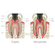 Pulpitis and Periodontitis Diagram Medical Science, Vectors | GraphicRiver