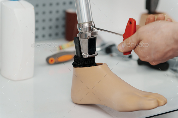 Master screwing and tightening metal part of modern prosthetic leg ...
