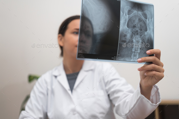 At hospital, doctor radiologist conducts a detailed examination of the ...