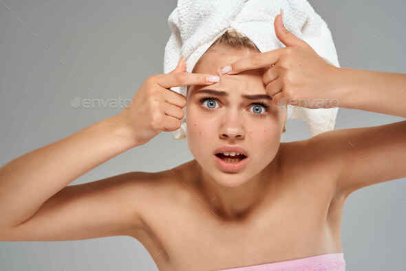 woman with a towel on her head squeezes pimples on her forehead skin ...