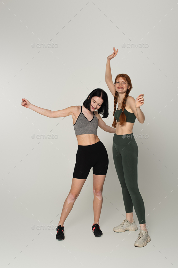 Cheerful young sportswomen with vitiligo and freckles dancing together ...