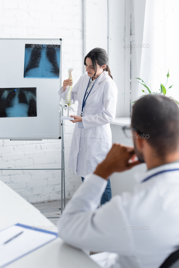 young doctor holding spine model neat flip chart with x-rays and ...
