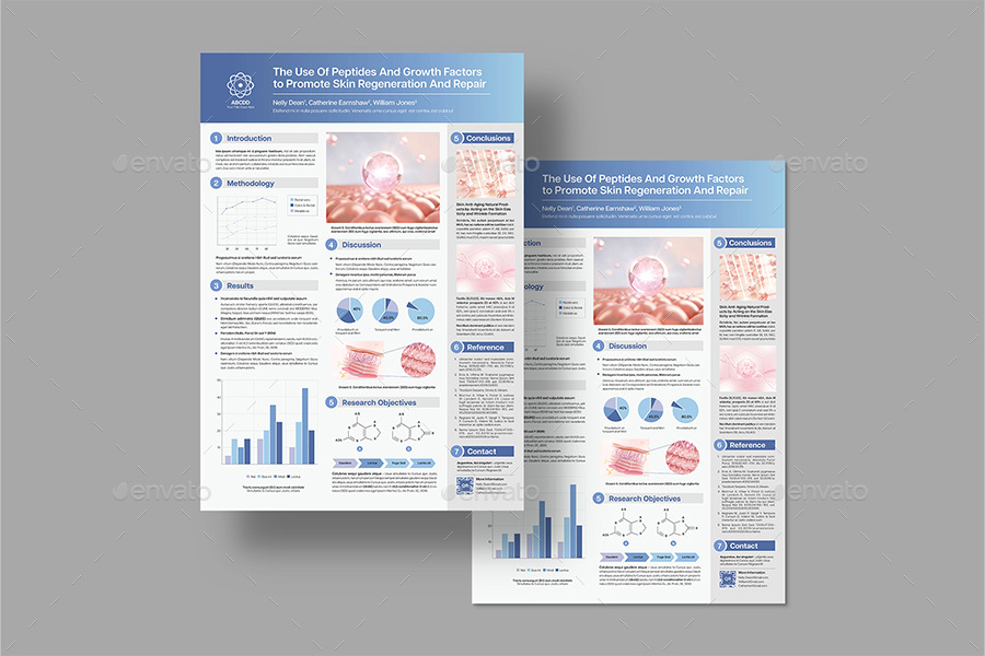 Case Study Research Poster Template, Print Templates | GraphicRiver