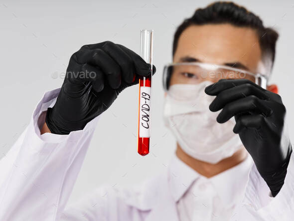 Male Asian appearance black gloves Laboratory blood test research ...