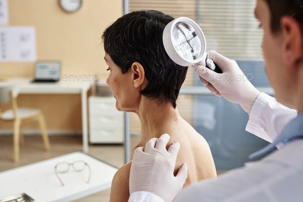Close up of doctor holding magnifying glass examining head of female ...