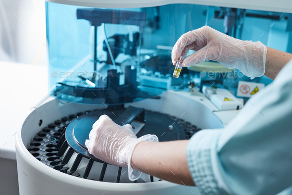 medical laboratory assistant working with a glass flask on a centrifuge ...