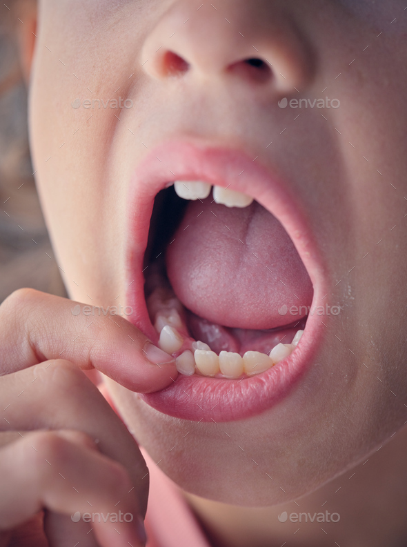 Crop kid with open mouth showing teeth Stock Photo by ADDICTIVE_STOCK
